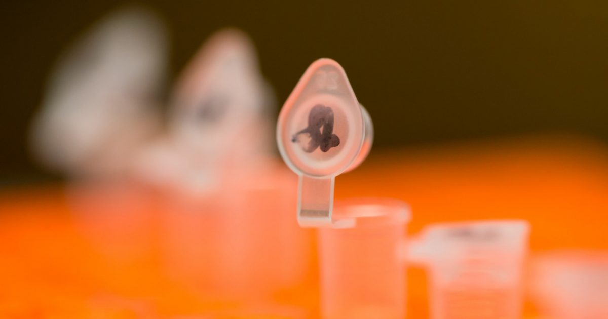 CRISPR/Cas9 Approach for Cystic Fibrosis Treatment | Cystic Fibrosis ...