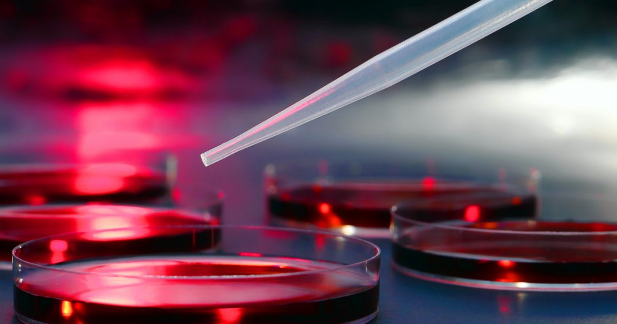 Growing Lung Bacteria in Lab May Predict Antibiotics' Effectiveness Better