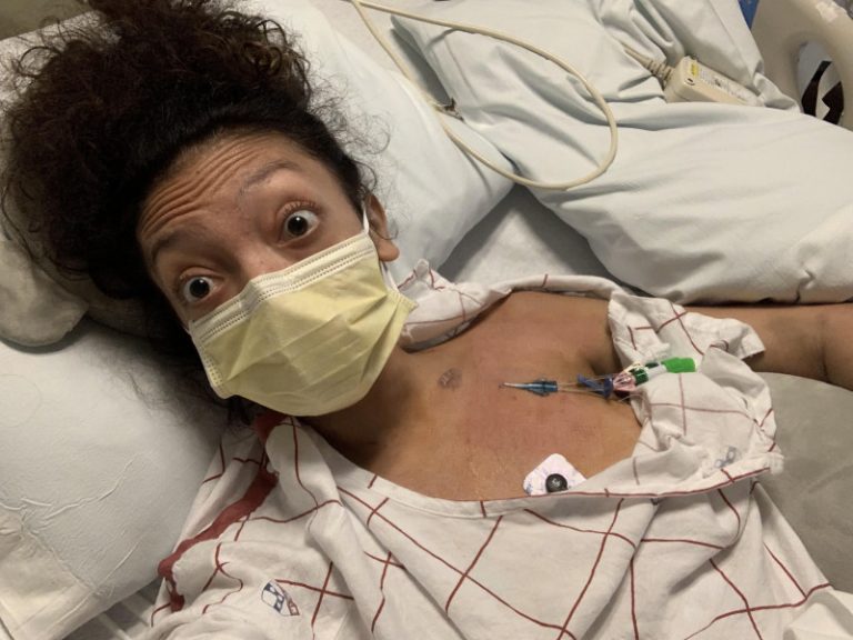 Learning to Embrace My Poor Unfortunate Holes and Scars